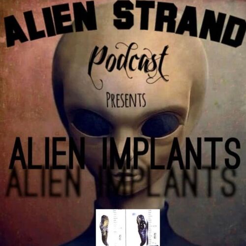 Alien Implants Episode 72: Alien Implants And Abductions Last
