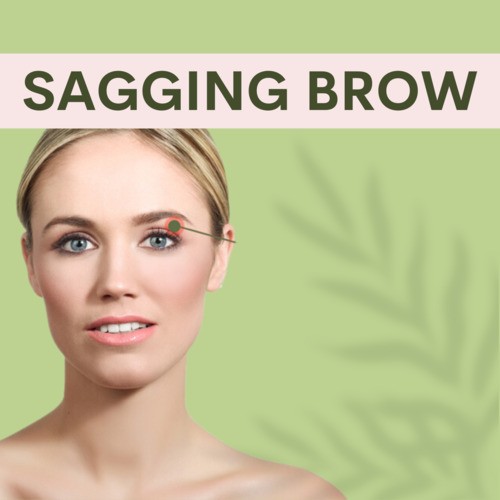 Sagging Brow, Botox and Filler Treatments Clinic Surat, Gujarat, Mumbai ...