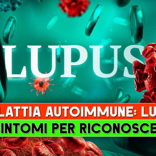Malattia Autoimmune, Lupus: I 7 Sintomi Per Riconoscerla! from Guida al ...