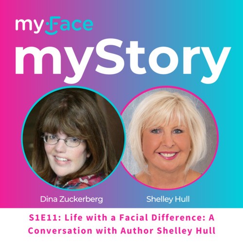 Life with a Facial Difference: A Conversation with Author Shelley Hull ...