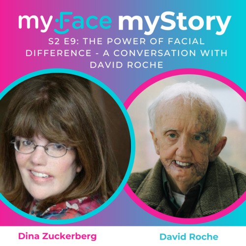 The Power of Facial Difference: A Conversation with David Roche from ...